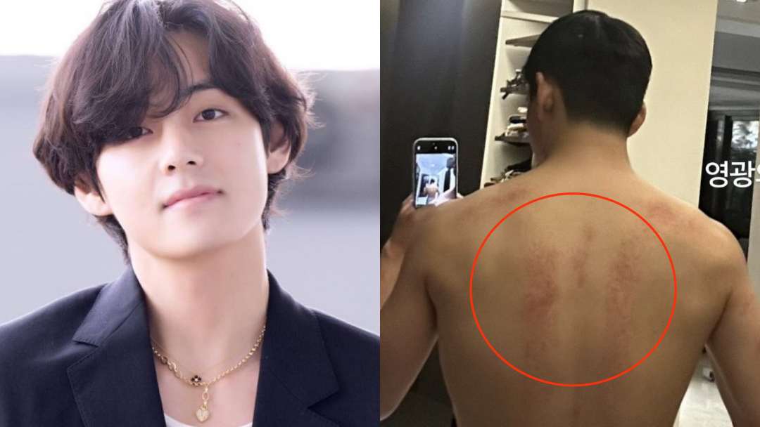 تايهيونغ من فرقة BTS يثير الجدل بسبب ابعاد جسده المثيرة - آراكيبوب | ‎arakpop